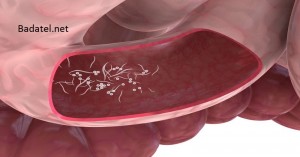 85% ľudí má v tele parazity: Zistite príznaky a ako sa ich zbaviť